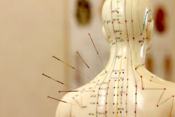 Acupuncture and TCM Aurora - Momentum Therapy